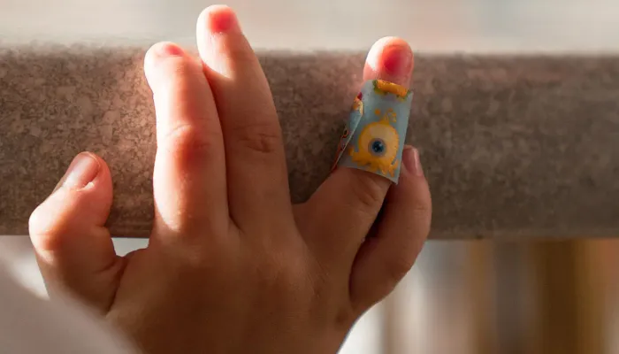 What is Patch Management? Manage App Lifecycle Process & Benefits